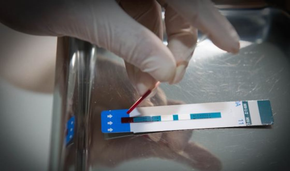 Solo el 50% de los infectados alcanza un nivel indetectable del VIH ...