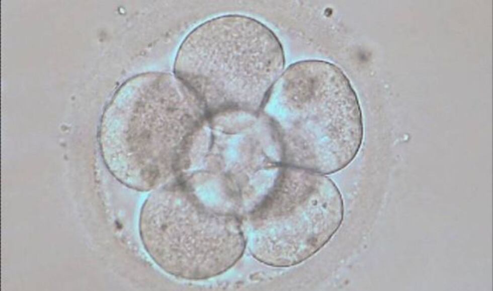 Una nueva pista para identificar el embrión perfecto | Ciencia | EL PAÍS