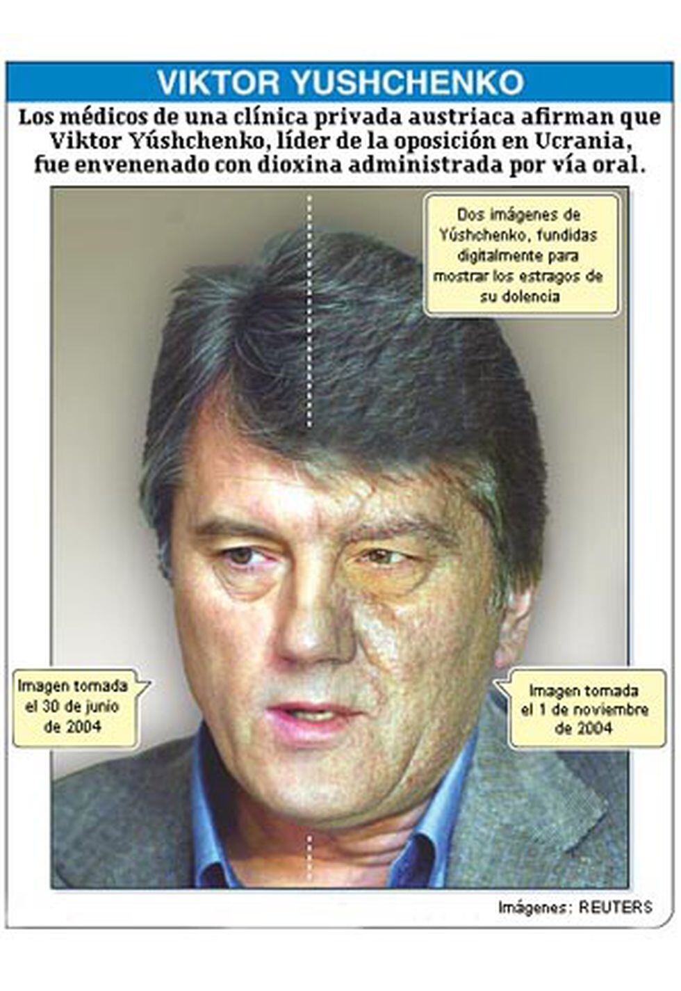 Los médicos que tratan a Yúshenko en Viena determinan que fue ...