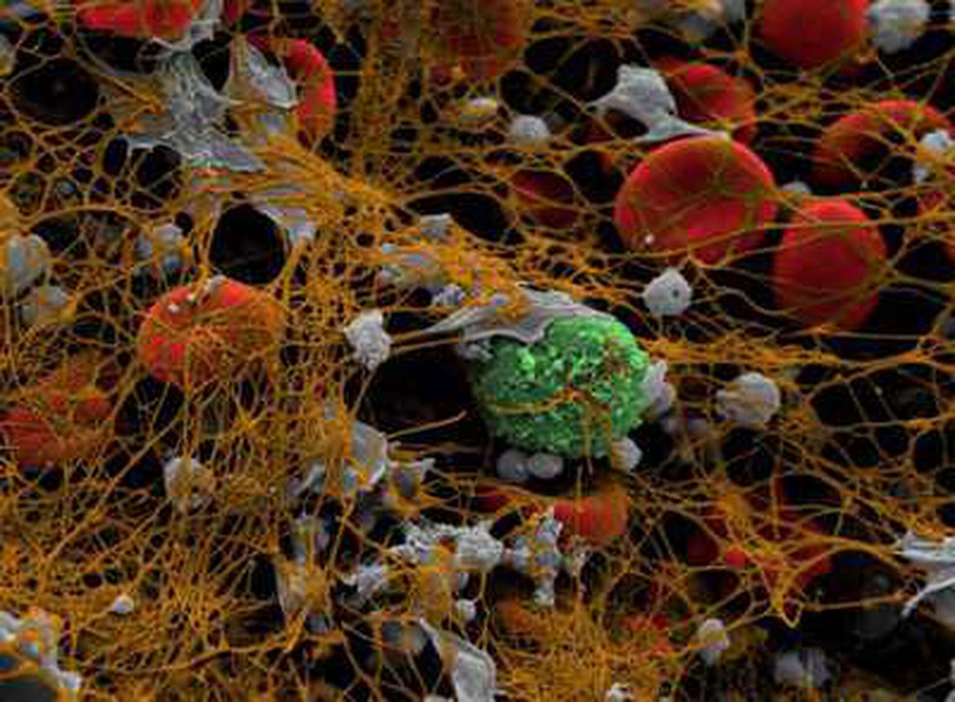 Cómo se forman los trombos en la sangre | Sociedad | EL PAÍS