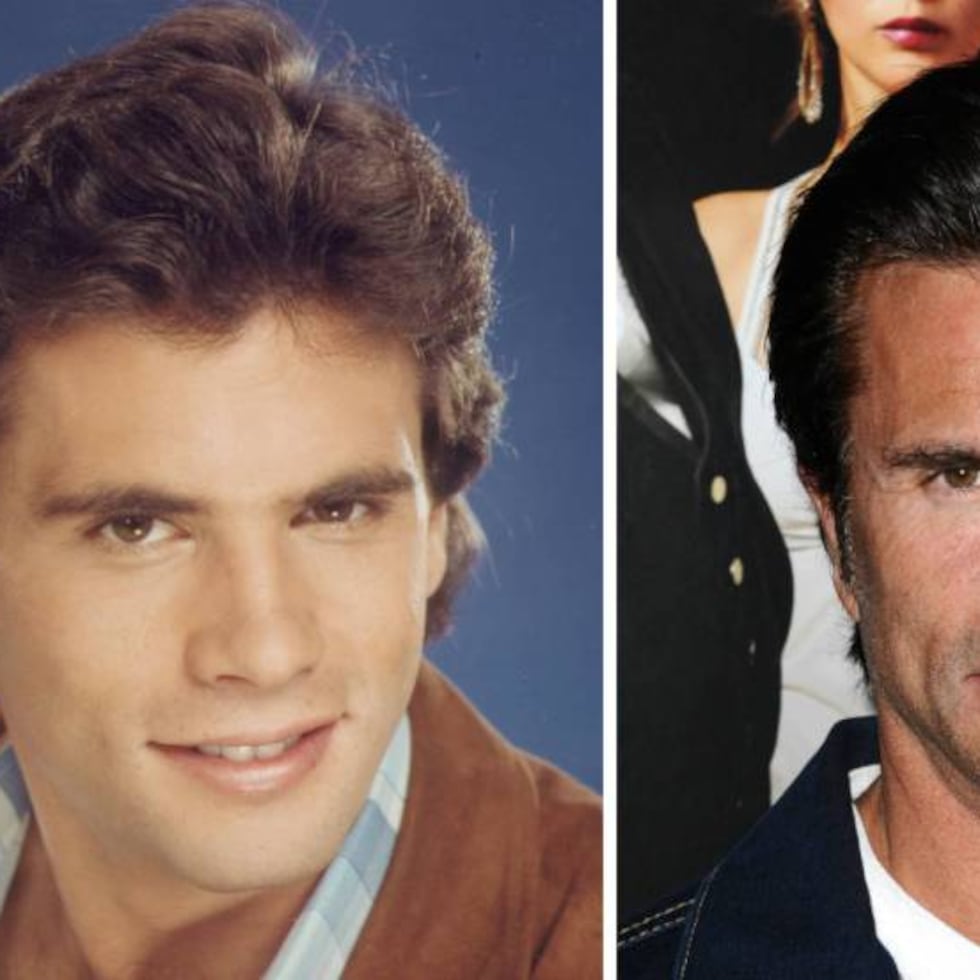 Lorenzo Lamas Plastic Surgery