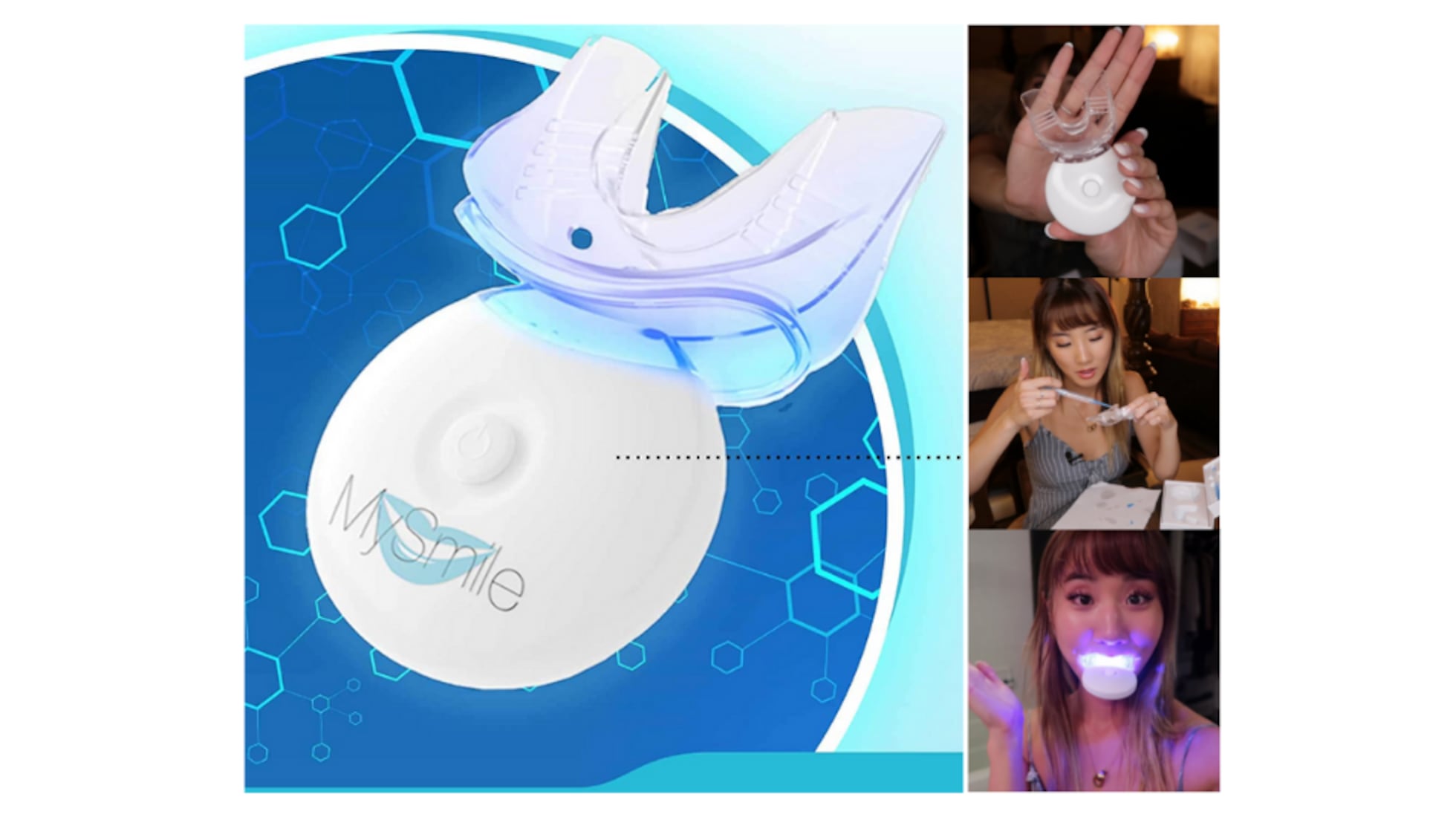 Logra una sonrisa perfecta con el blanqueador dental con más de 17,000 ...