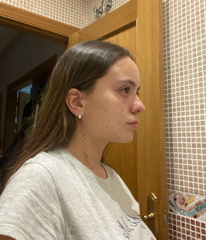 Núria Jordà, la ‘tiktoker’ que cuenta su día a día con disfagia: “No he ...