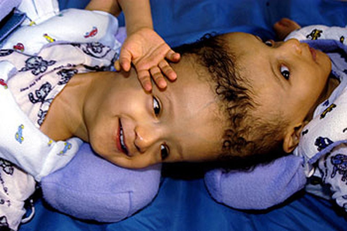 Los siameses egipcios | Sociedad | EL PAÍS