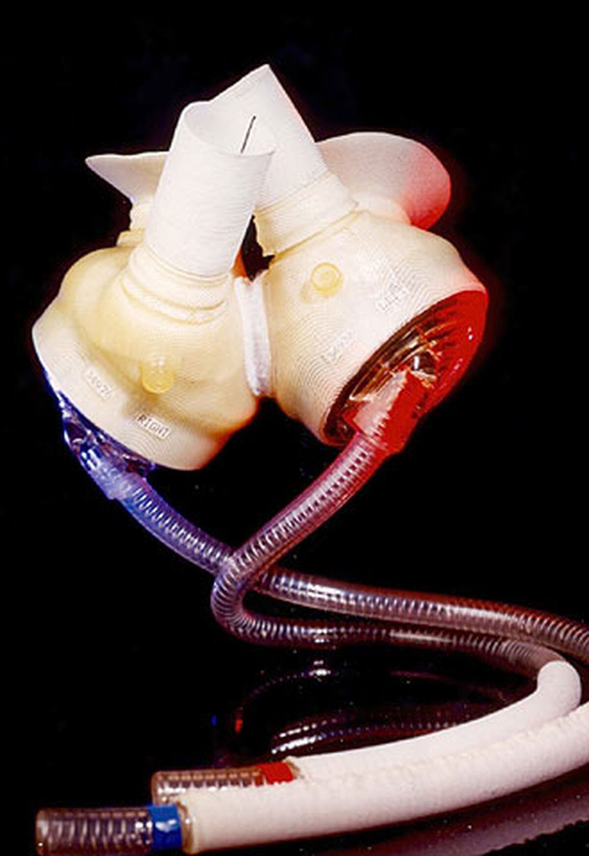 El corazón artificial Cardiowest | Sociedad | EL PAÍS