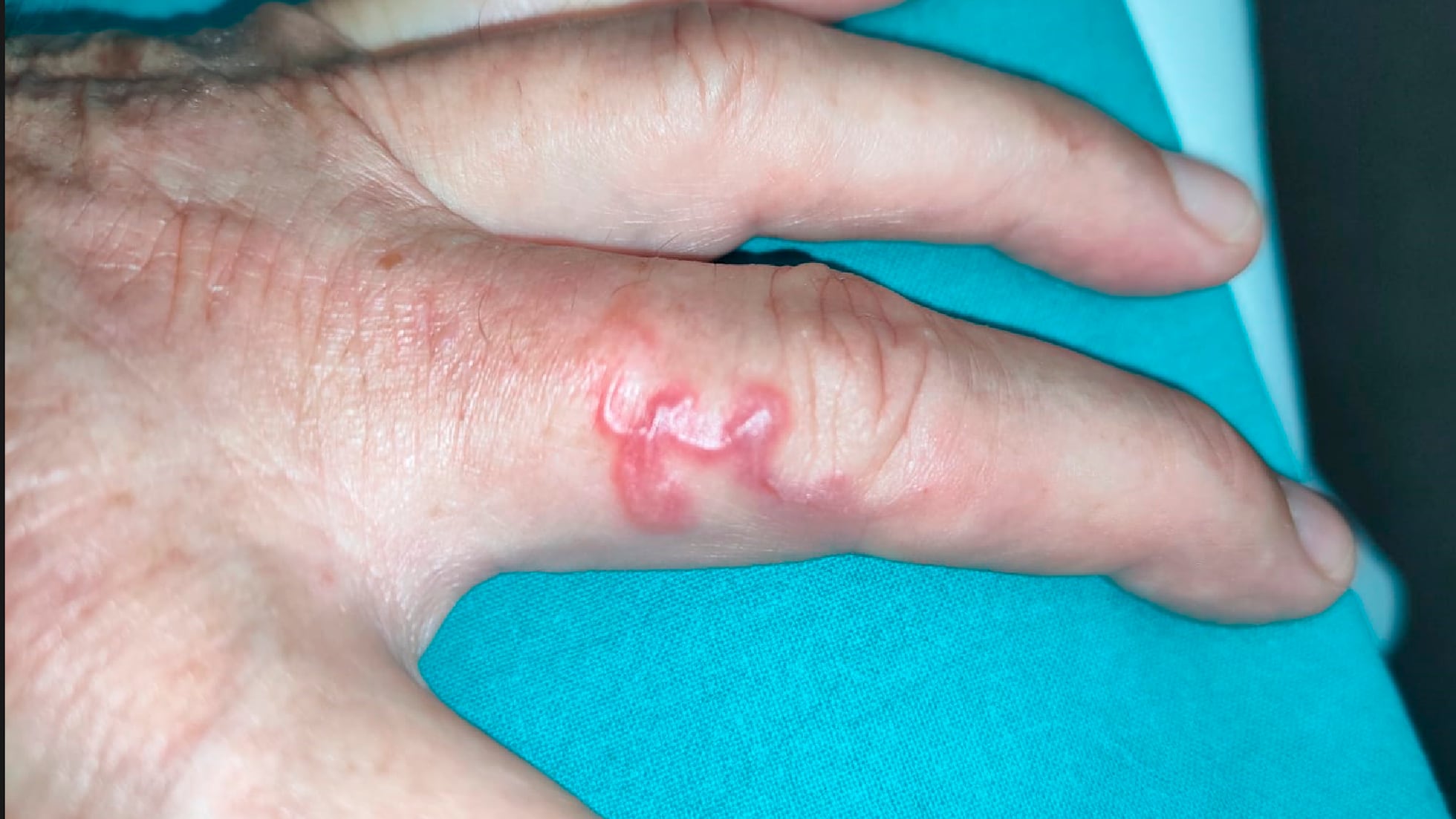 Pueden Los Gusanos Causar Picazón En La Piel De Los Perros