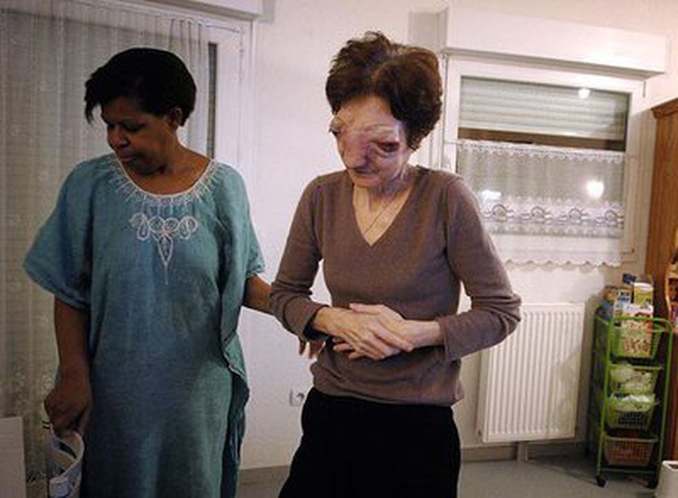 Francia investiga quién ayudó a morir a Chantal Sébire | Sociedad | EL PAÍS