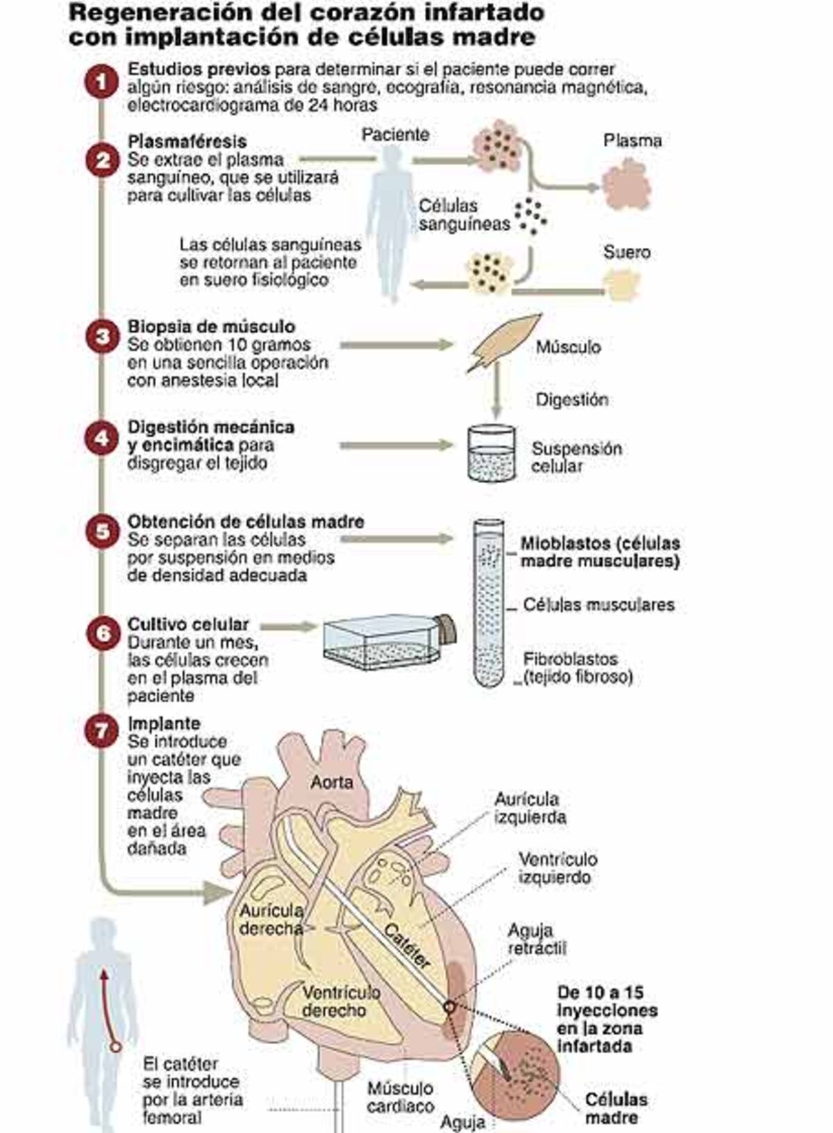 Regeneración del corazón infartado | Salud y bienestar | EL PAÍS