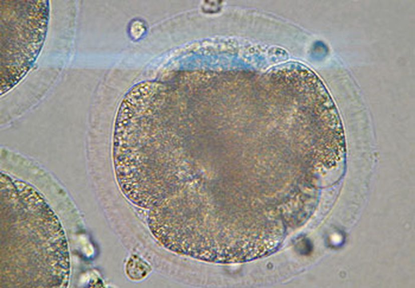 Imagen del supuesto embrión humano clonado, ofrecida por la empresa ...