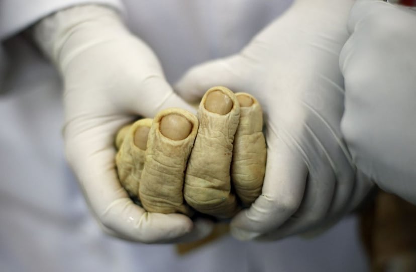 Cadáveres para la ciencia | Fotos | Universidades | EL PAÍS