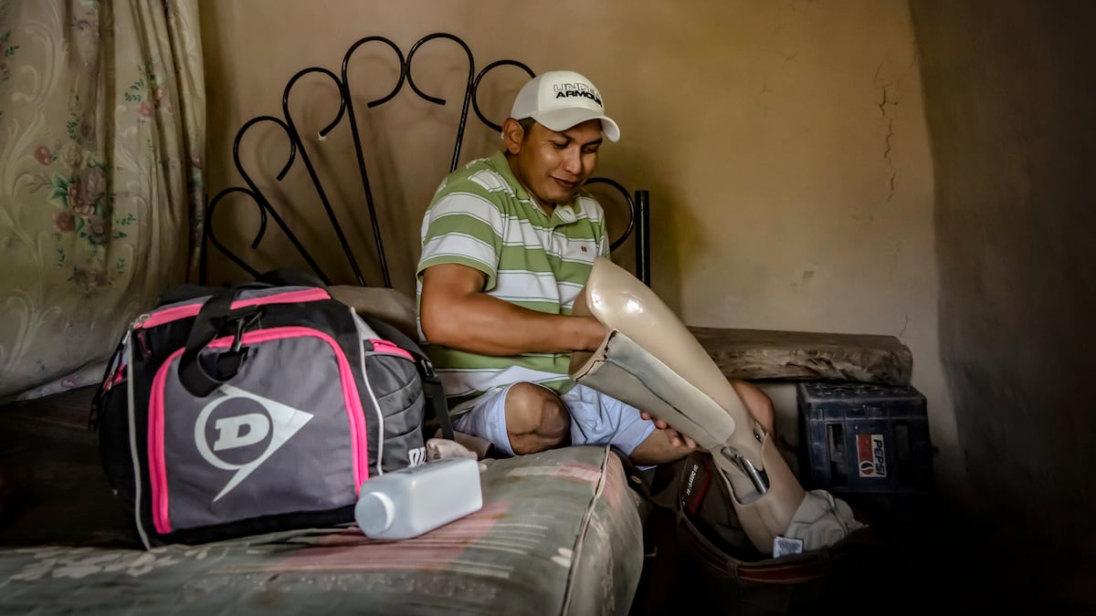 Los migrantes mutilados por ‘La Bestia’: en busca de una nueva vida ...