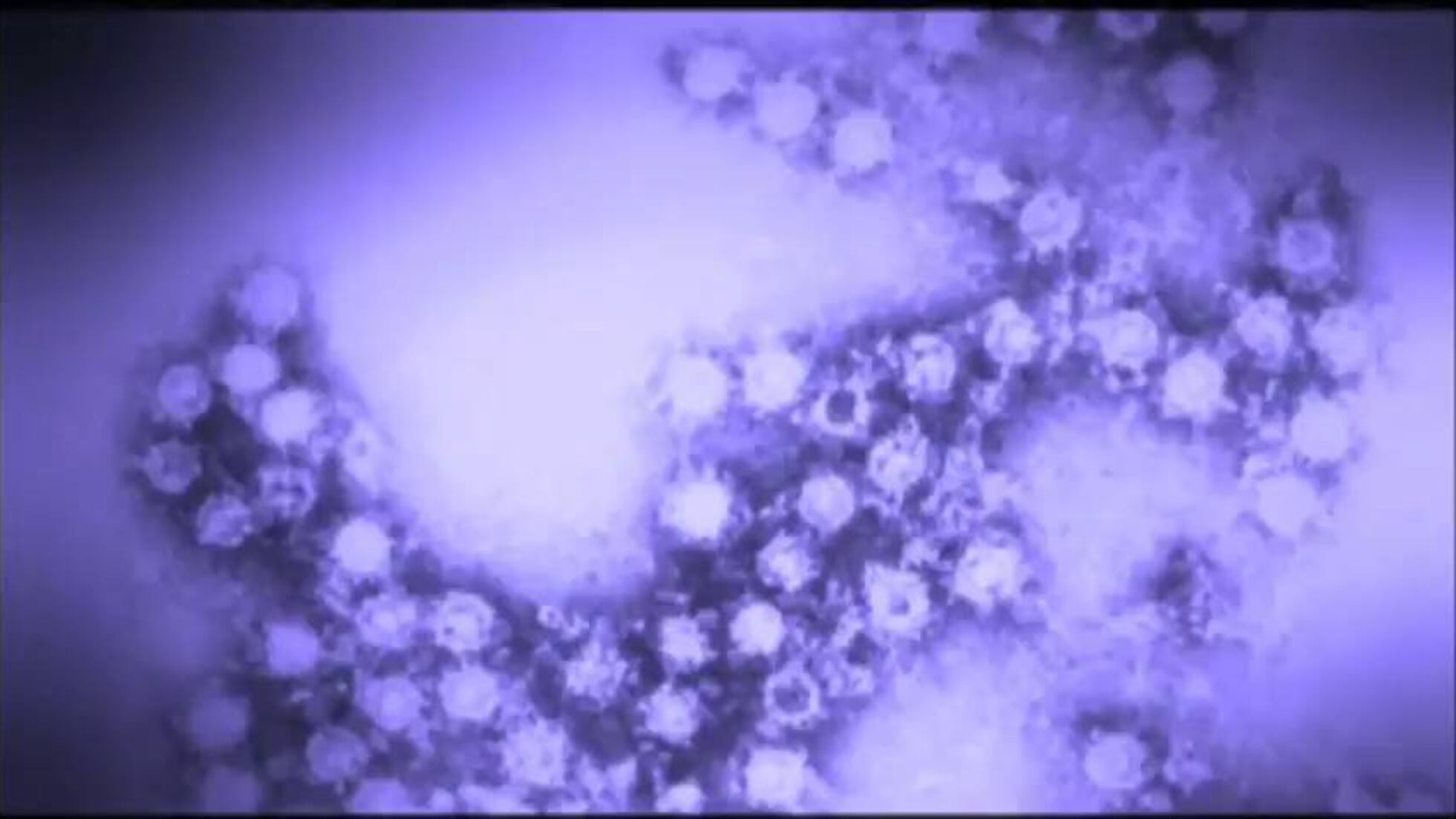 ¿Qué es el enterovirus y cuáles son sus síntomas? | Cataluña | EL PAÍS