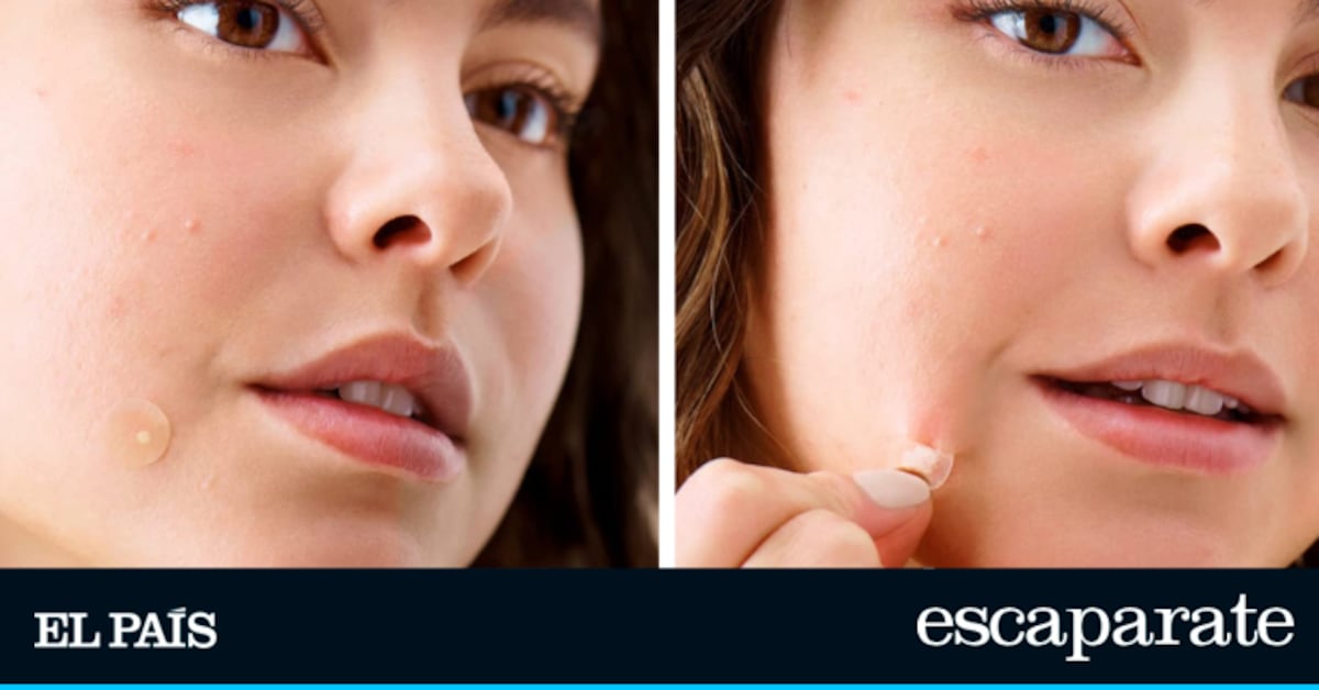 Di adiós a las imperfecciones con los parches para acné superventas en ...
