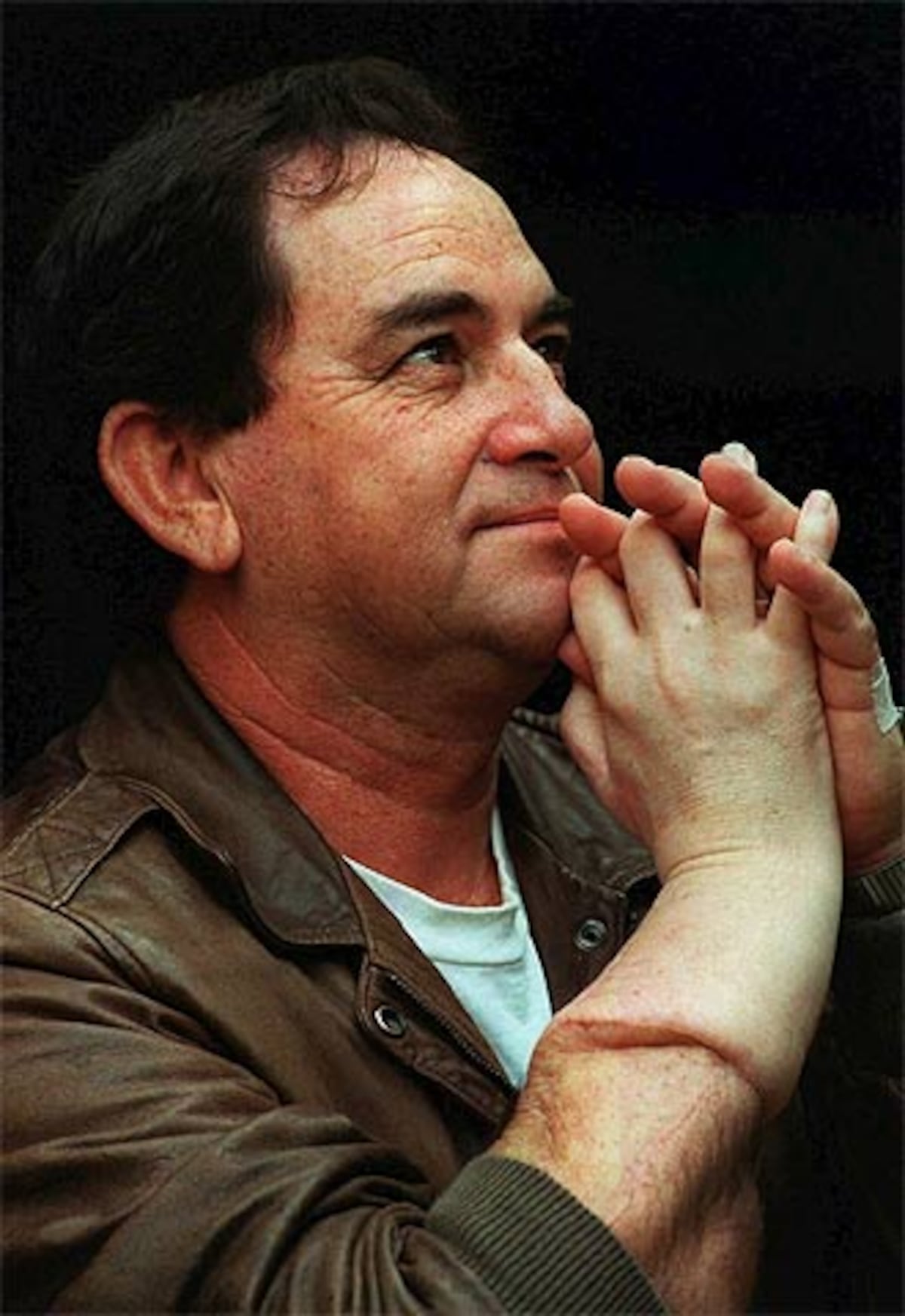 Clint Hallam, primer trasplantado de mano | Salud y bienestar | EL PAÍS