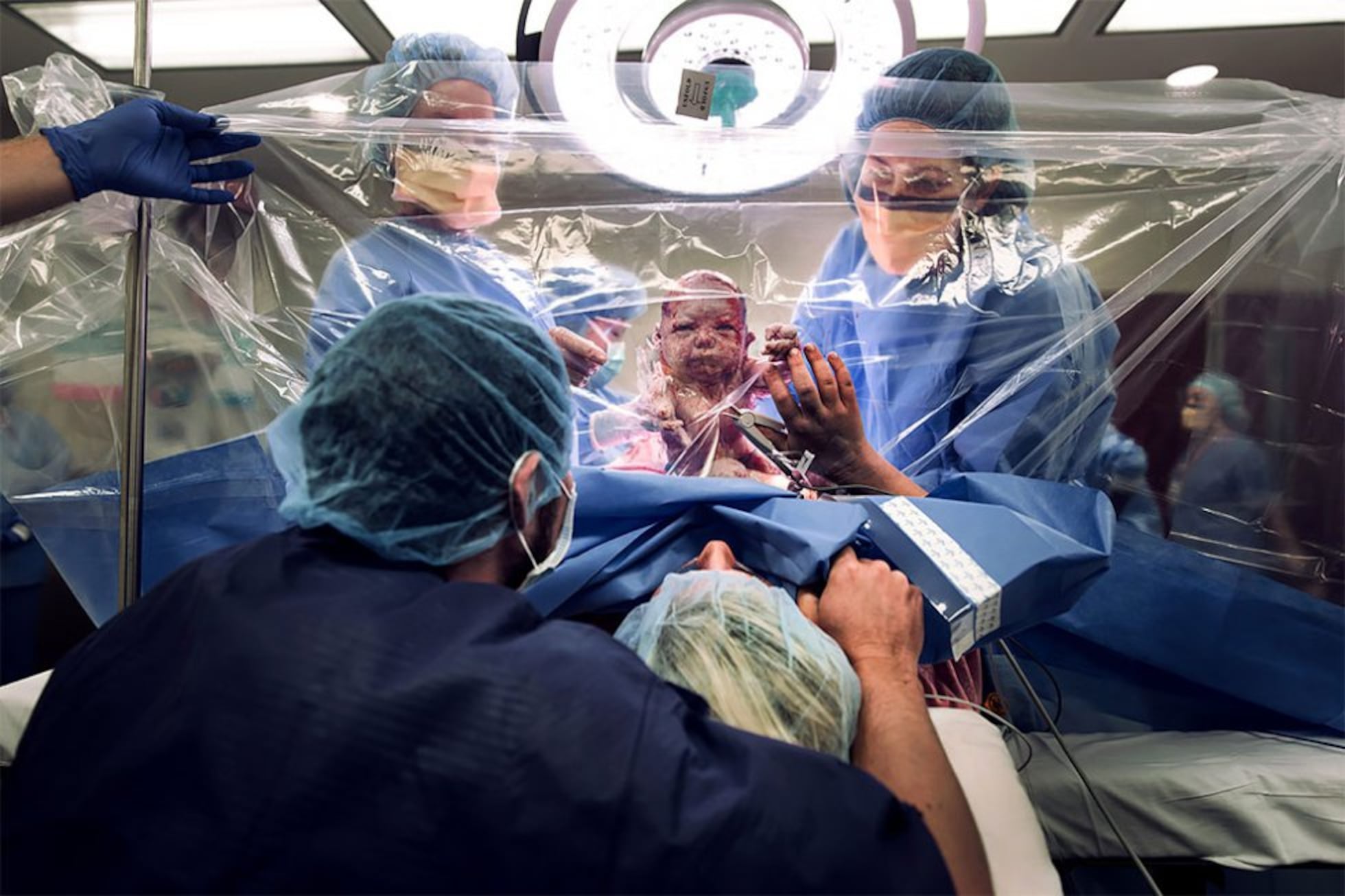 Las mejores fotos de partos de 2017 | Fotos | Los Blogs de | EL PAÍS