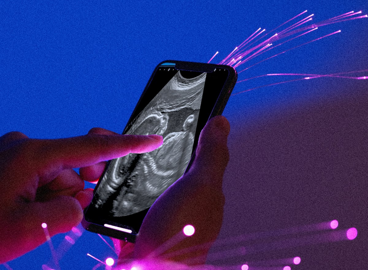 Por qué debería ser anónimo el donante?“: así es ‘el Tinder del esperma ...