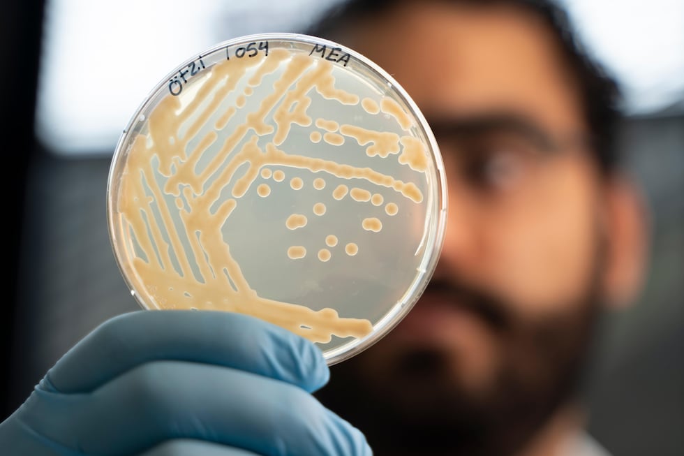 Los microbios de Ötzi, el hombre de los hielos, se despiertan miles de ...