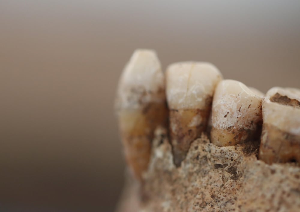Tartar on ancient teeth shows Paleolithic humans had better oral health ...