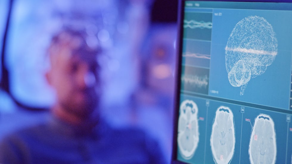 The computer that runs on human neurons | Technology | EL PAÍS English