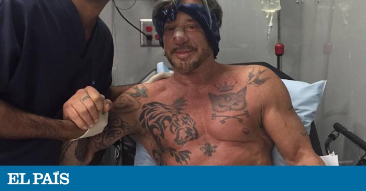 Mickey Rourke se opera de nuevo la nariz y lo enseña en Instagram ...