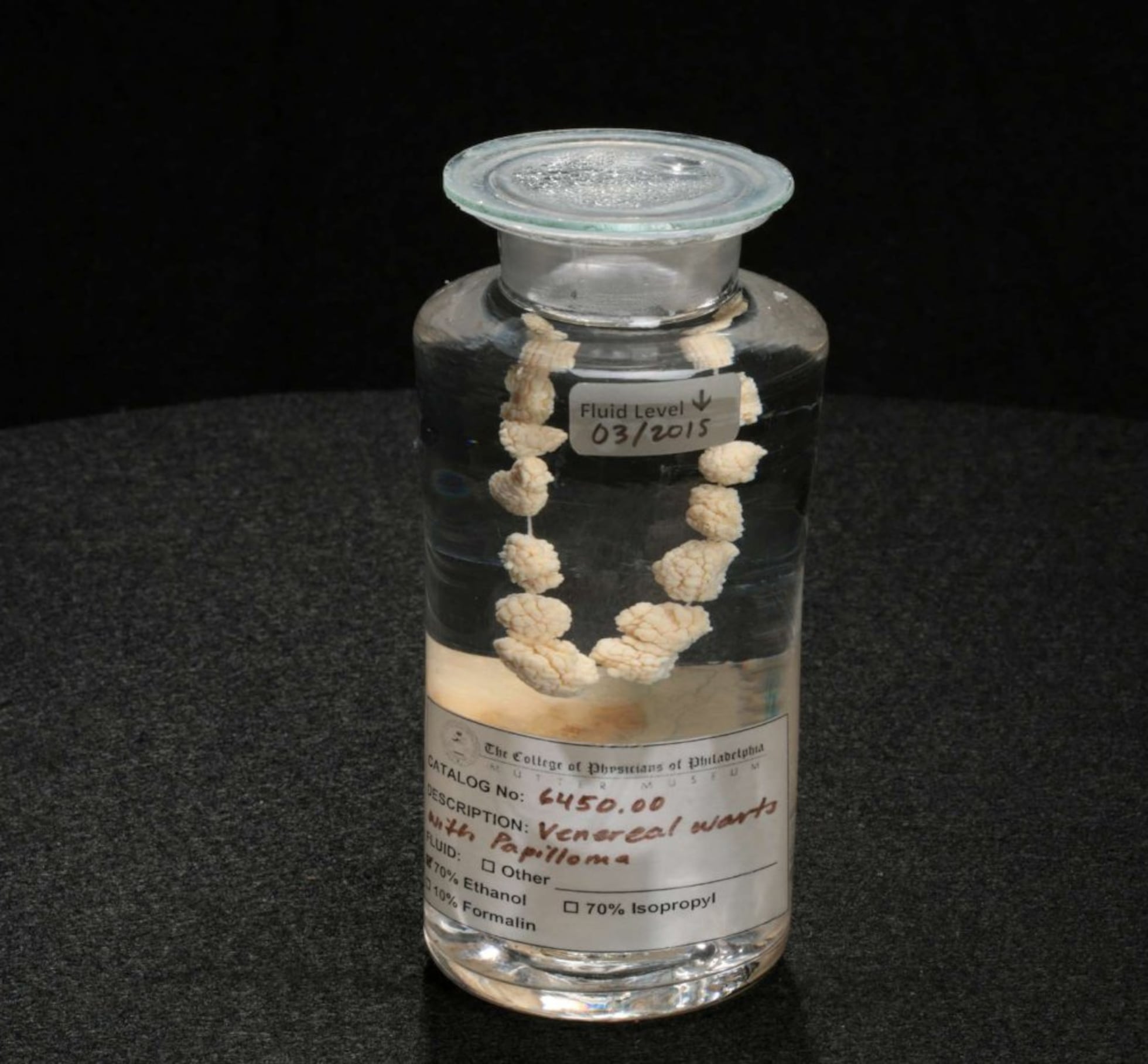 The controversy over displaying human remains, like the ‘giant’ brought ...
