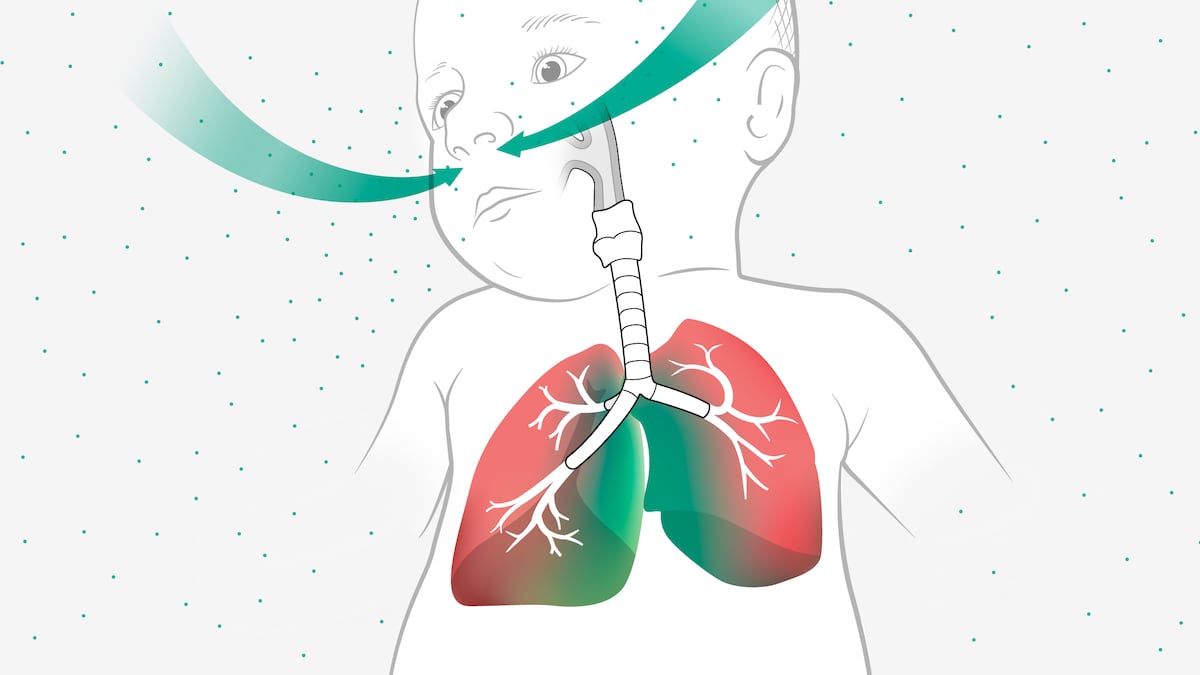 Cómo reconocer los síntomas de la bronquiolitis en un bebé | Salud y bienestar | EL PAÍS
