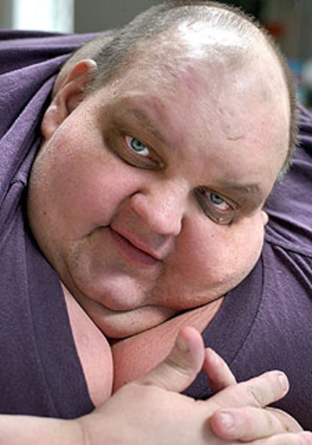 Patrick Deuel, ingresado en un hospital por obesidad | Sociedad | EL PAÍS