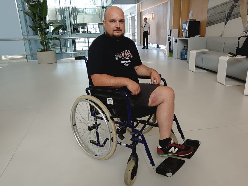 Cuando los amputados de la guerra se convierten en ‘superhumanos’ (y ...