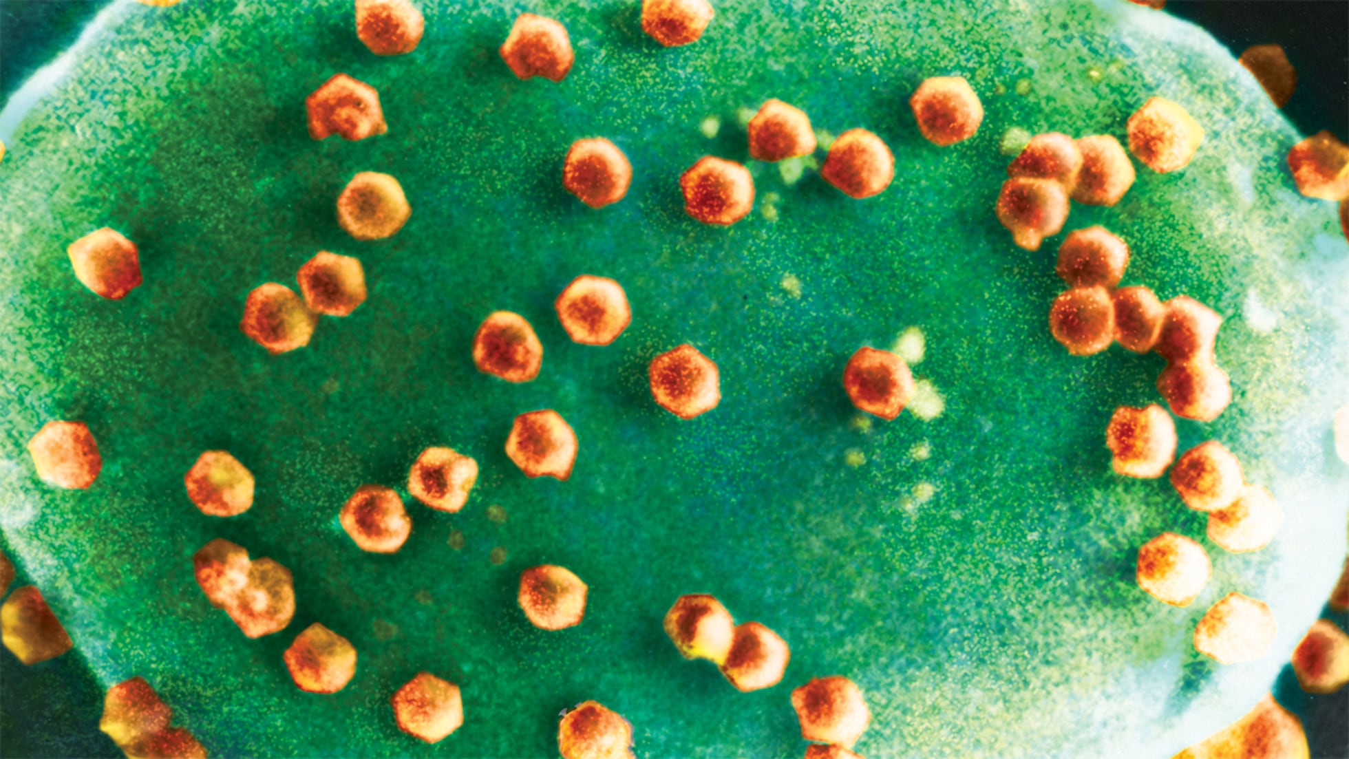 El primer ‘virívoro’: un organismo que se puede alimentar solo de virus ...