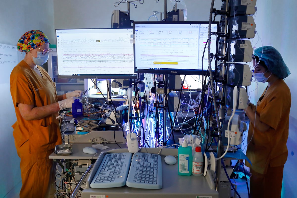 Artificial placenta keeps sheep fetus alive for 12 days: ‘We have to ...