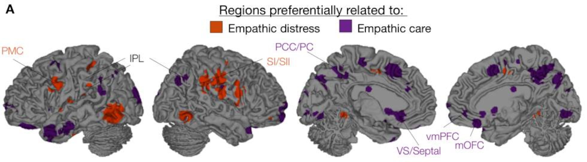 Un escáner del cerebro muestra dónde se esconde la compasión humana ...