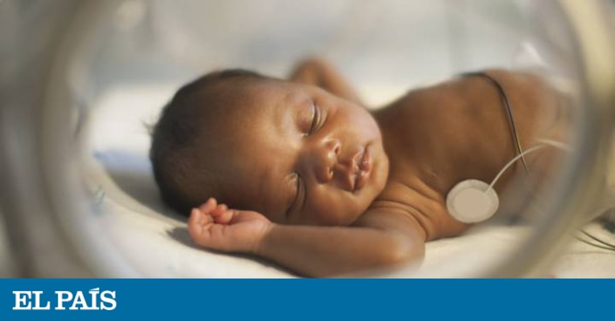 Birrete y foto para los bebés que se ‘gradúan’ de la UCI de prematuros ...