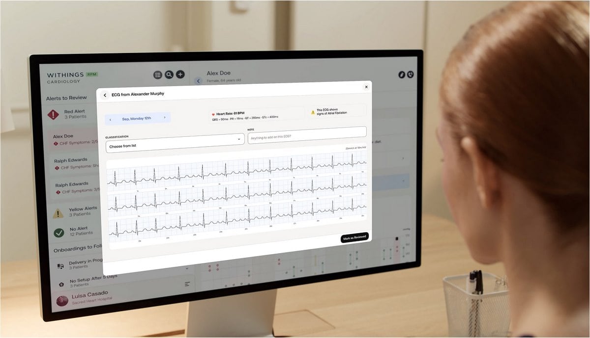 Cómo compartir un informe Health Link de Withings con tu médico ...