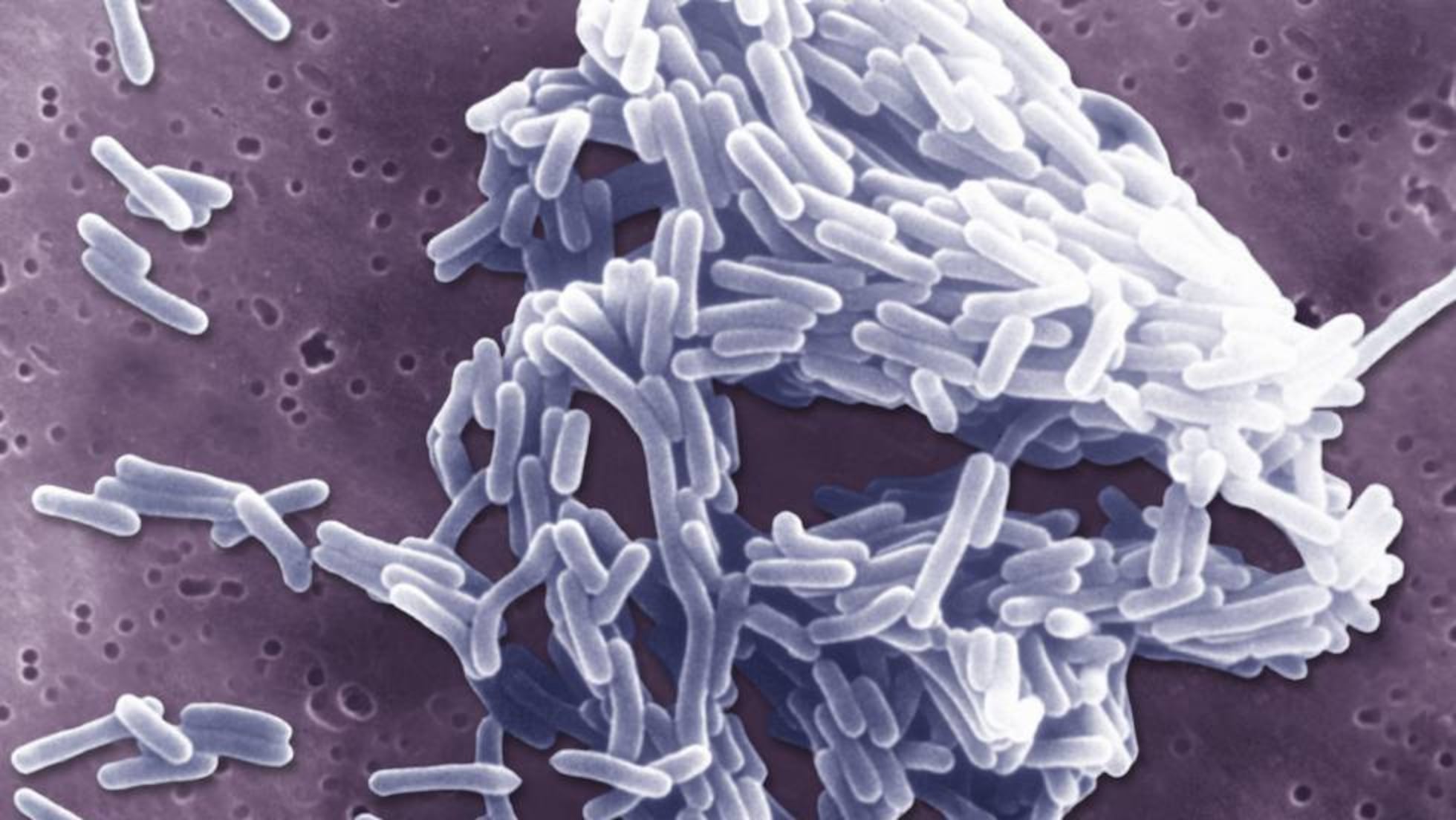 Qué es la listeria y qué hacer en caso de alerta alimentaria | El ...