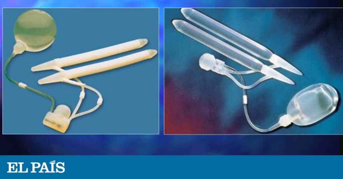 Les pròtesis de penis incrementen la seva vida útil | Quadern | EL PAÍS