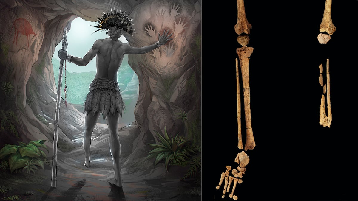 Archaeology: A foot that was amputated 31,000 years ago illuminates the ...