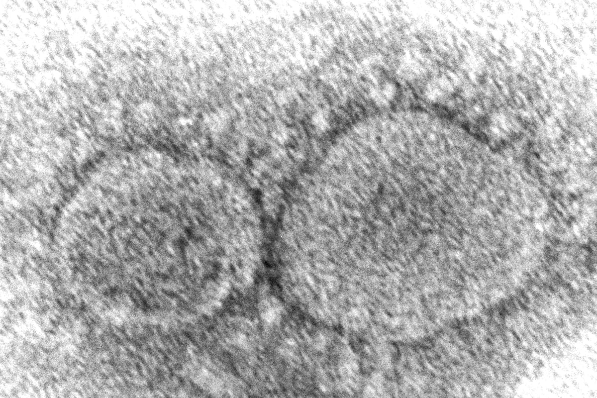Coronavirus origins still a mystery three years into pandemic | Science ...