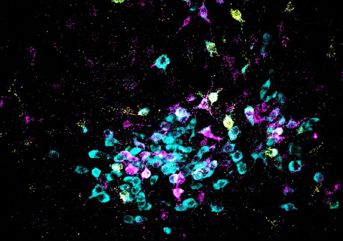 Fear arises from chemical changes deep in the brain | Science | EL PAÍS ...