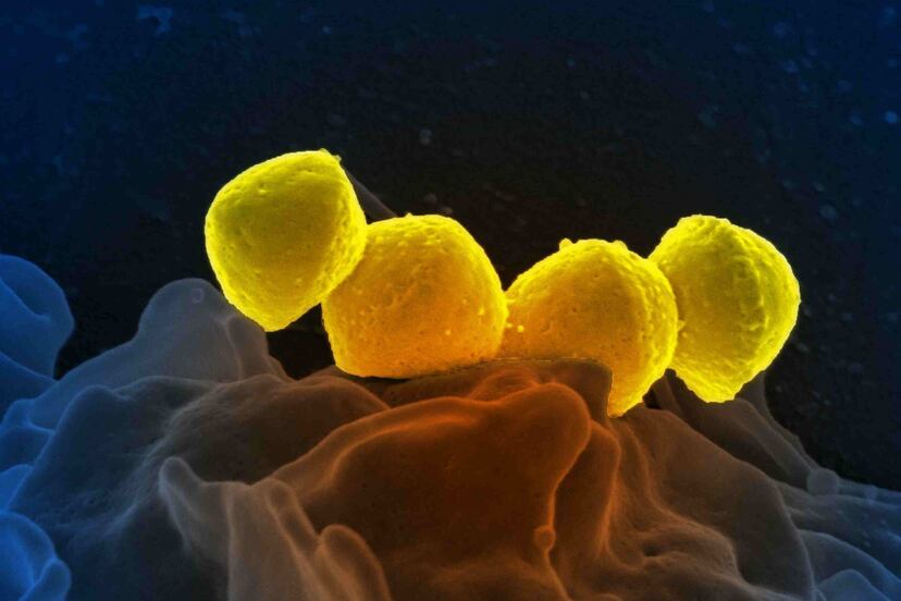 Streptococcus Pyogenes: La ‘bacteria asesina’ en Chile: qué es, cómo se ...