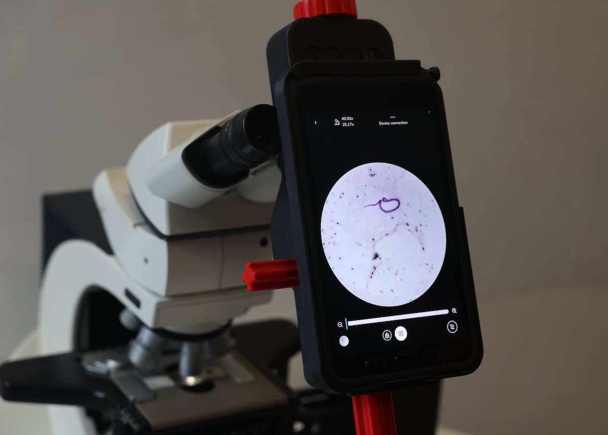 MultiplexAI, un ‘filtro de Instagram’ contra la malaria, vital para África: inteligencia ...