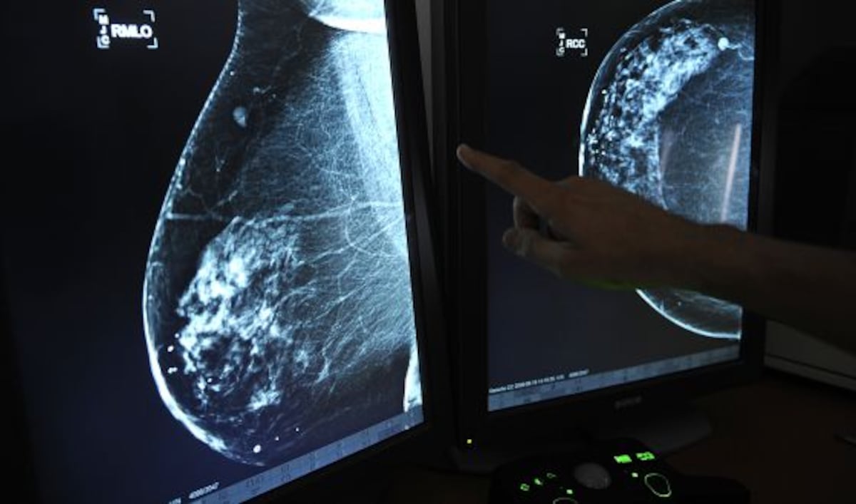 A más gasto sanitario, más supervivencia al cáncer | Sociedad | EL PAÍS