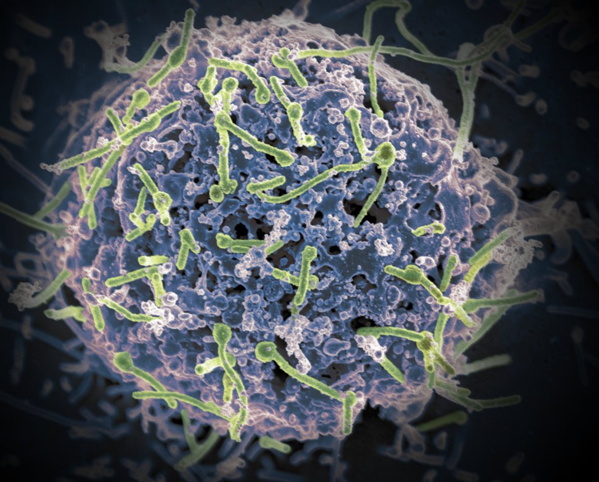 Los virus más infecciosos del último siglo, en imágenes | Fotos ...