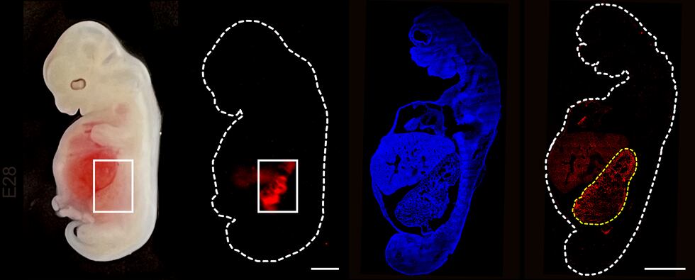 The first human organ created inside an animal opens the door to ...