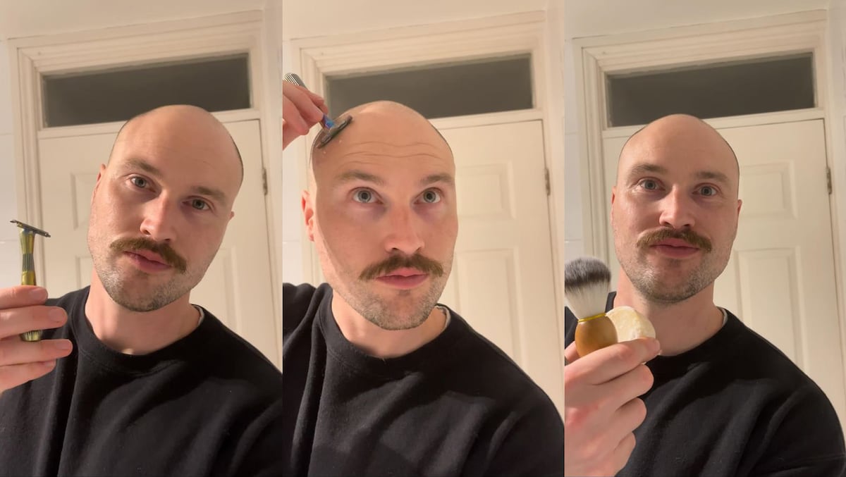 Harry James, the influencer who advocates for bald pride | Society | EL ...