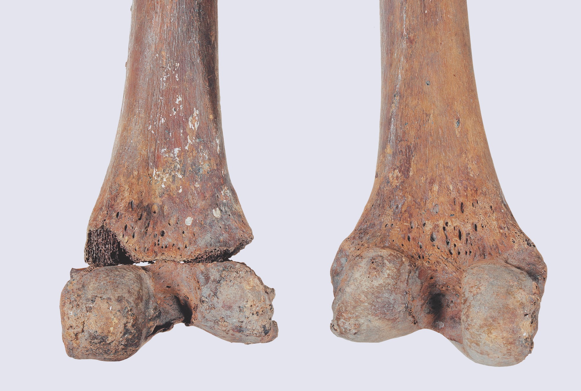 Los hombres y mujeres de la Edad Media sufrían las mismas enfermedades ...