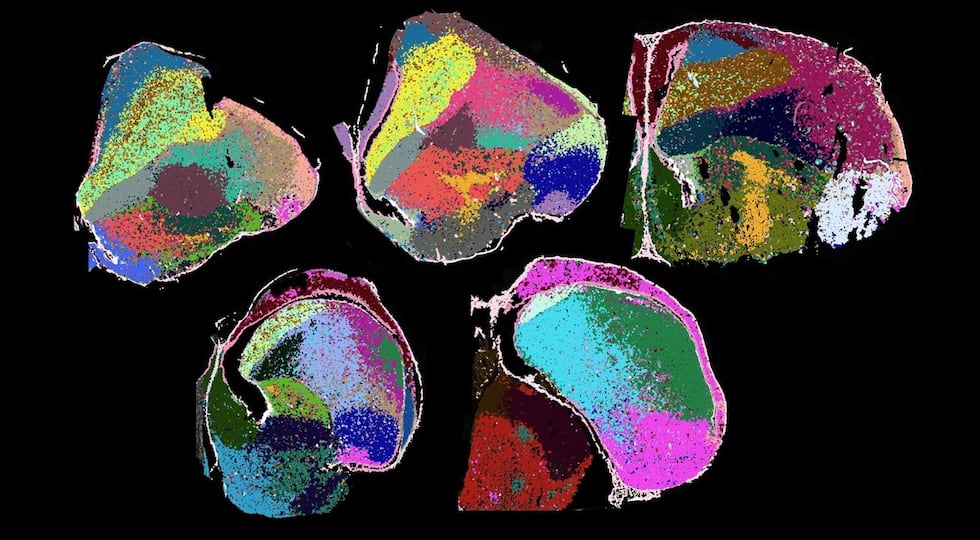 Mammals, birds, and reptiles evolved complex brains through different ...