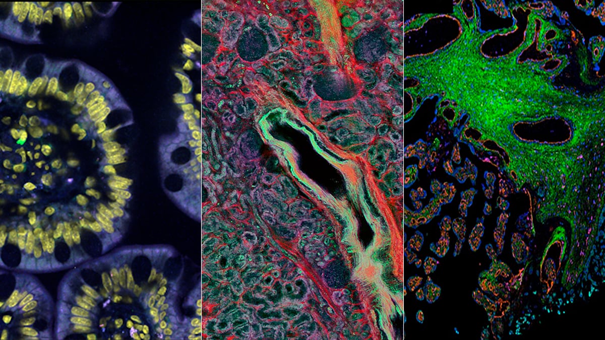 Three new atlases reveal a new dimension of the human body | Science ...