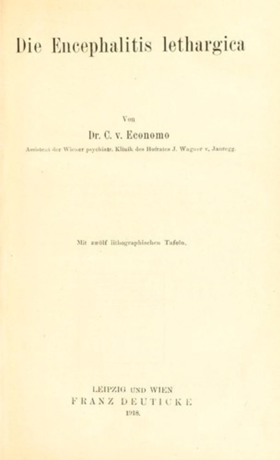 Encefalitis letárgica: La pandemia de los durmientes que emergió con la ...