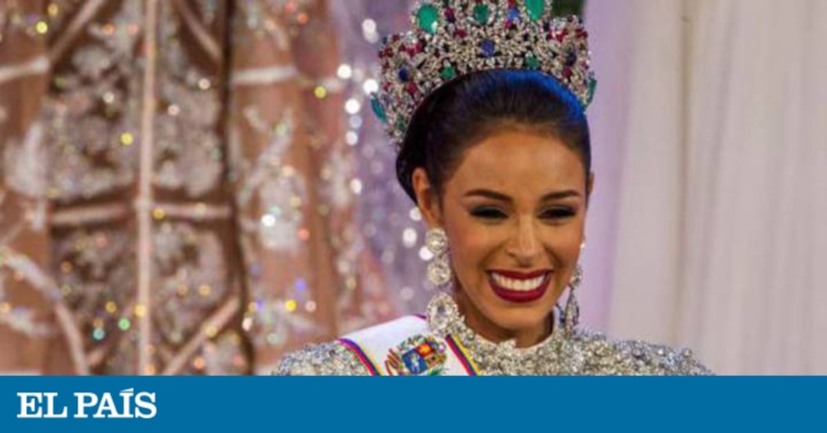 “Farei a cirurgia plástica que for necessária para ser Miss Venezuela ...
