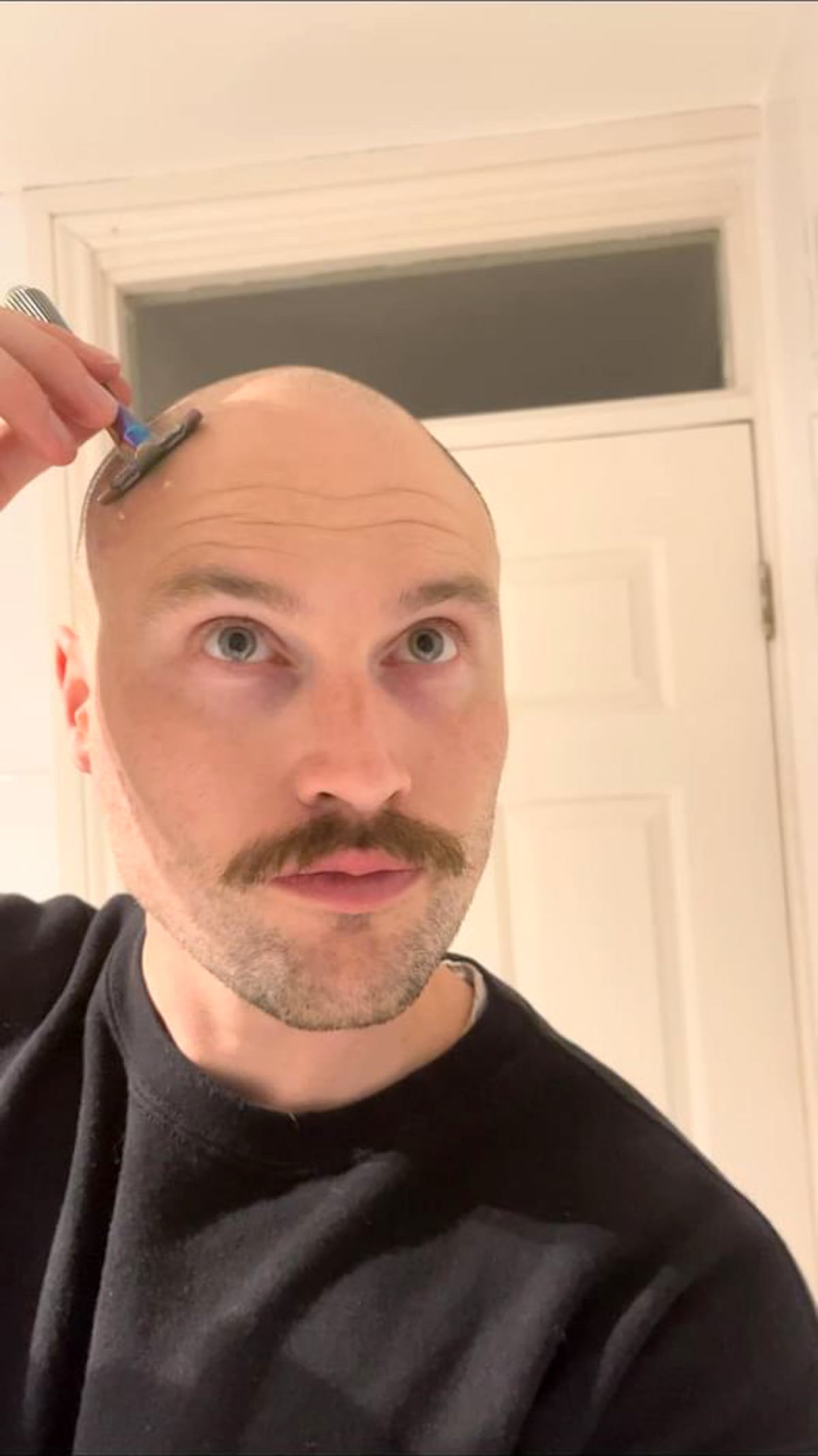 Harry James, the influencer who advocates for bald pride | Society | EL ...